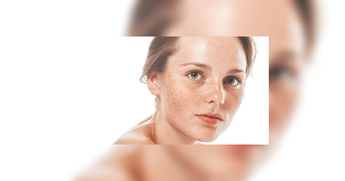 Seis curiosidades de las pecas que te harán entender que son hermosas