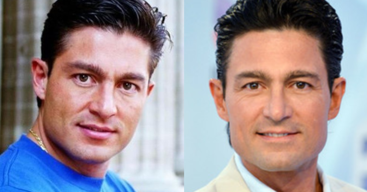 Fernando Colunga muestra el cambio de su rostro tras cirugía plástica ...