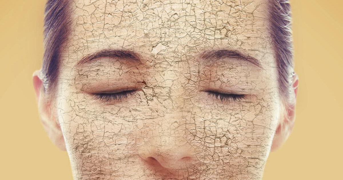 5 componentes que dañan la piel seca ¡Aléjate de ellos!
