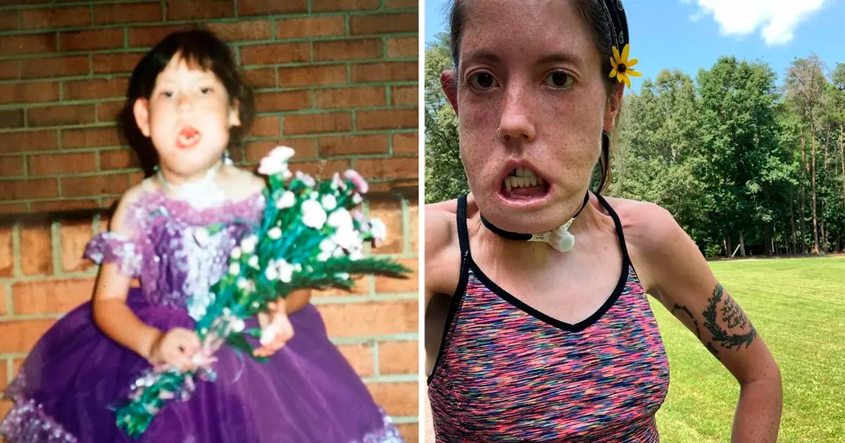 Mujer con anomalía facial pide “normalizar todos los cuerpos”