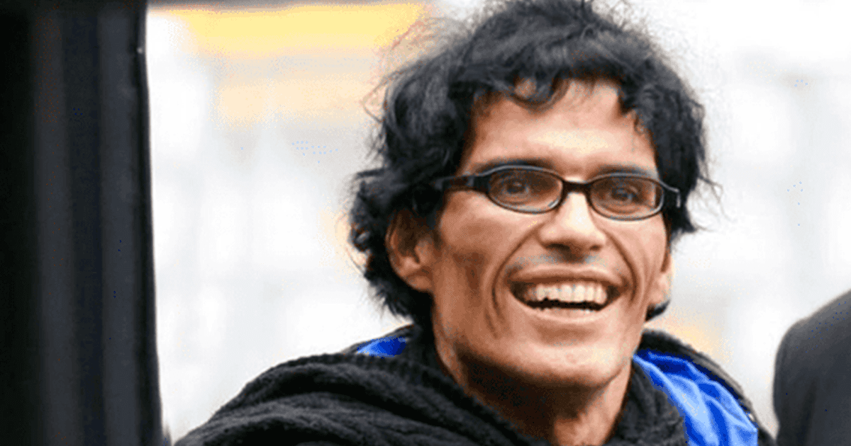 Pedro Suárez Vértiz ¿qué Es Disartria La Enfermedad Neuromuscular Que