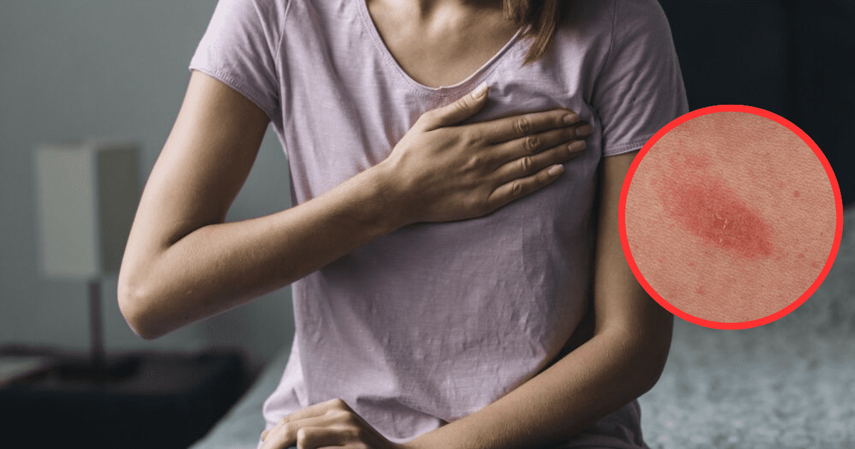 Manchas rojas en los senos: ¿una señal de alerta? Esto dicen los expertos