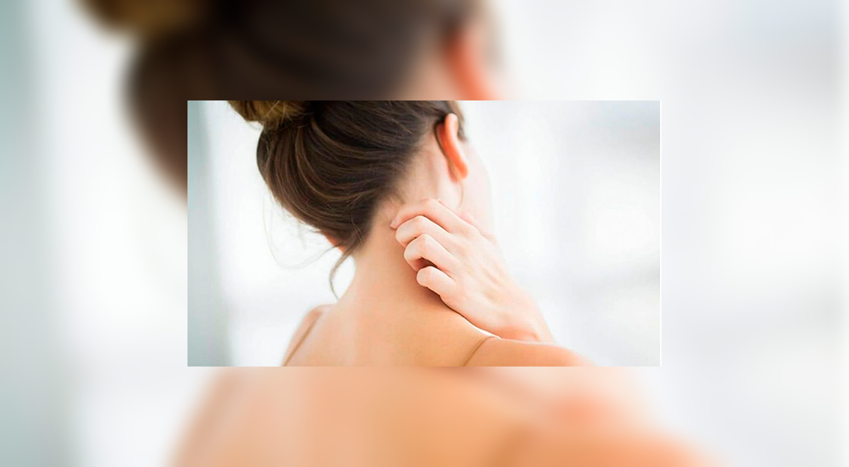 ¿Sientes picazón en el cuerpo? Puede ser la señal de estas siete ...